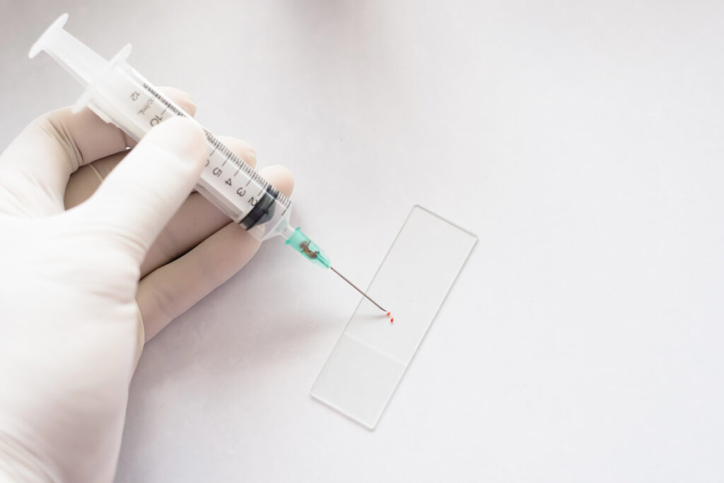 Fine Needle Aspiration (FNA) Biopsy: How to Prepare and What to Expect ...